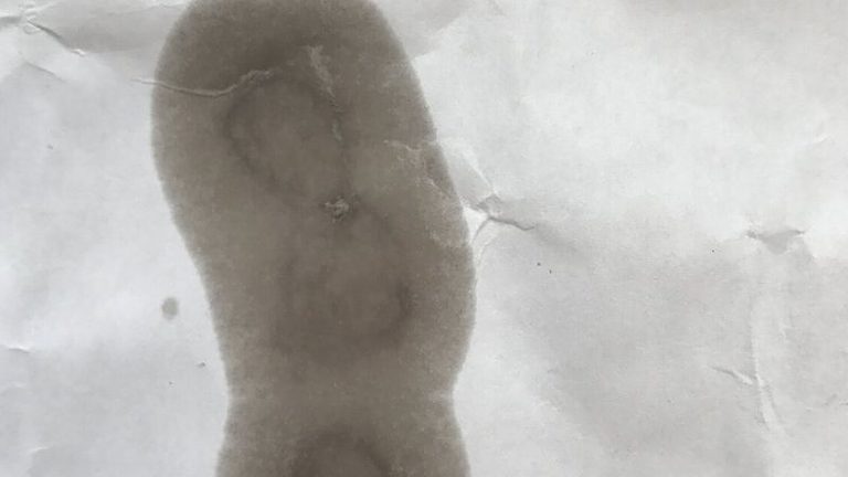 How to Interpret Diesel Engine Oil Analysis Results? - Take Your Oil